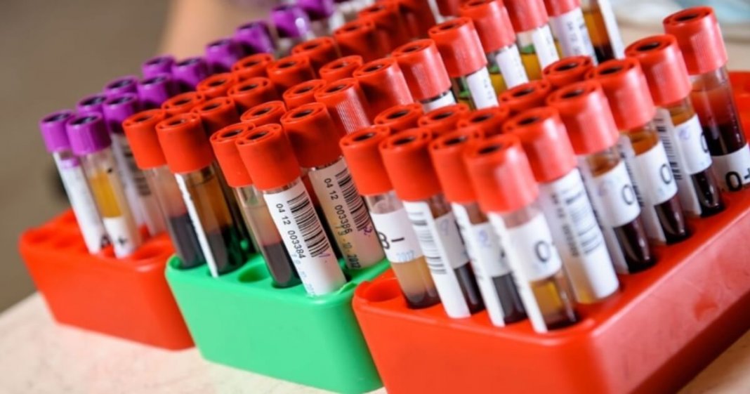 Cientistas criam tipo sanguíneo universal que pode salvar a vida de ...